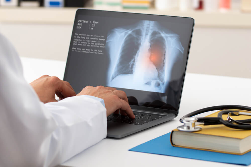 Optellum, AI Lung Cancer Diagnosis Innovator, Raises $14M in Series A ...